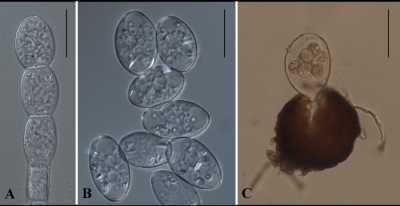 Mildiu - Podosphaera Leucotricha, cleistotecio, ascas y conidias ...